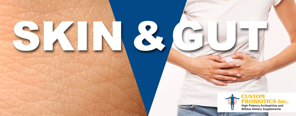 Skin Problems? Probiotics Can Help Improve Your Skin – Custom ...