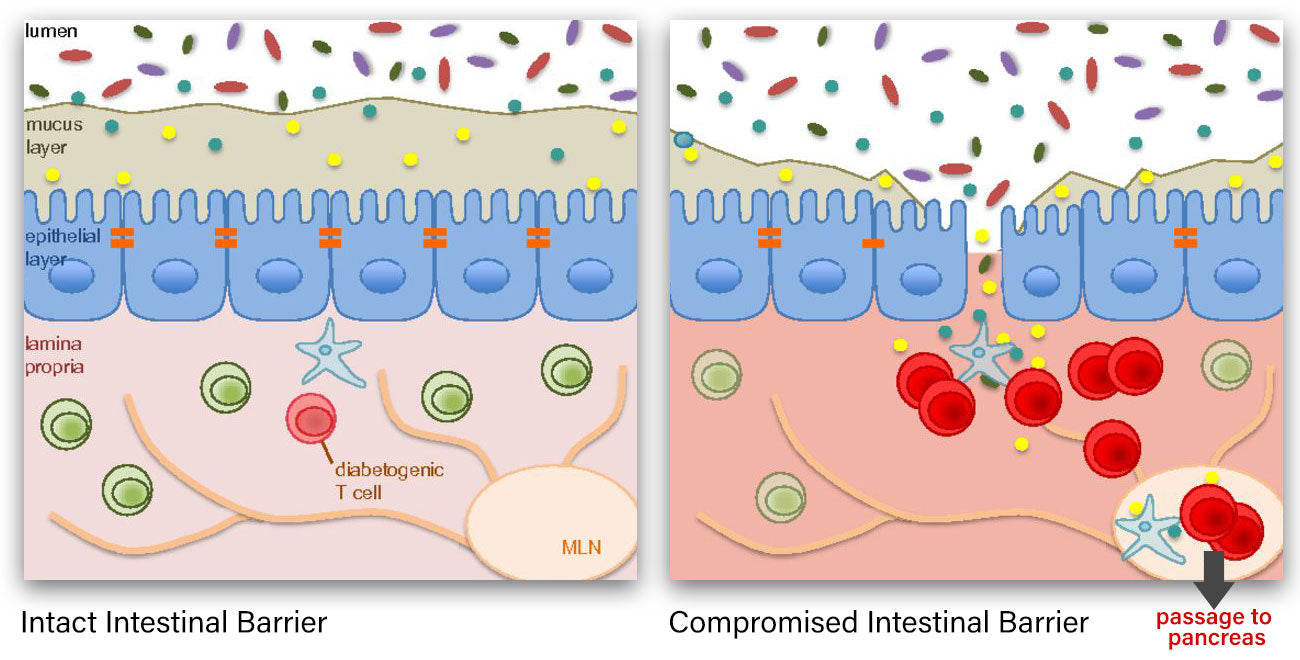 What to know about leaky gut syndrome – Custom Probiotics Inc.